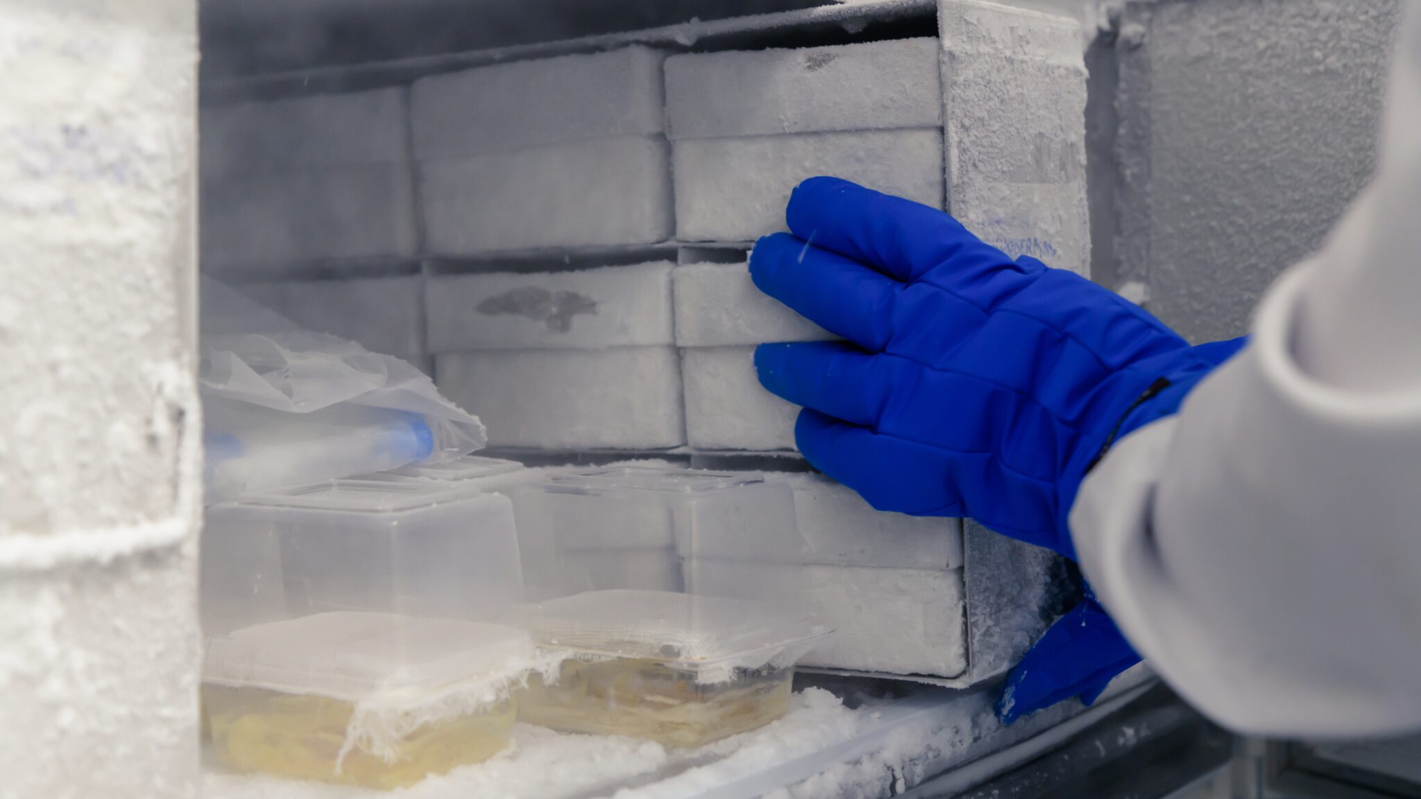 ULT Freezer Maintenance: Tips and Techniques for Ultra-Low Storage ...